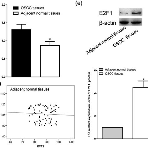 Relationship Between The Level Of Ect2 And E2f1 Mrna Expression In Oscc