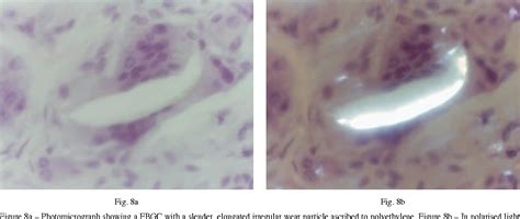 Figure 1 From Isolation Of Polyacetal Wear Particles From