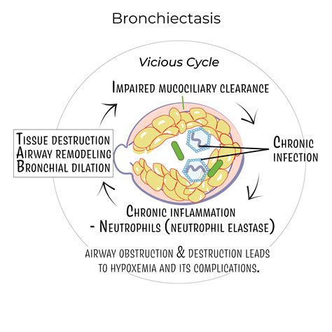 Usmle Comlex Step 3 Glossary Bronchiectasis And Bronchiolitis For Usmle Step 3 Ditki