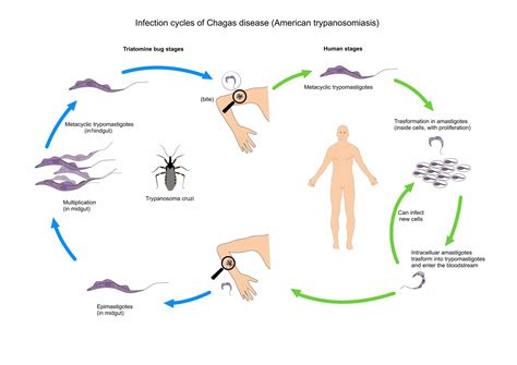 Chagas Disease Gideon Global Infectious Diseases And Epidemiology