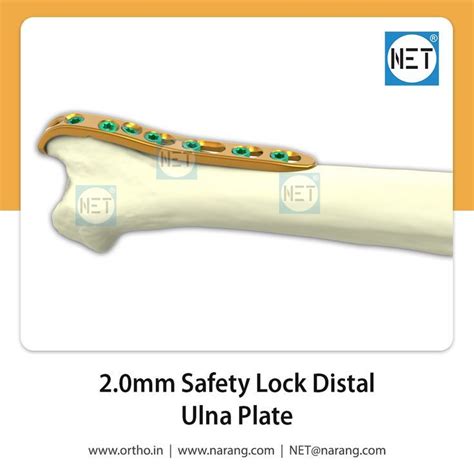Variable Angle Safety Lock Anterolateral Distal Tibia Plate Artofit