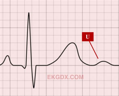 Ekgdx The New Era Of Ekg Learning