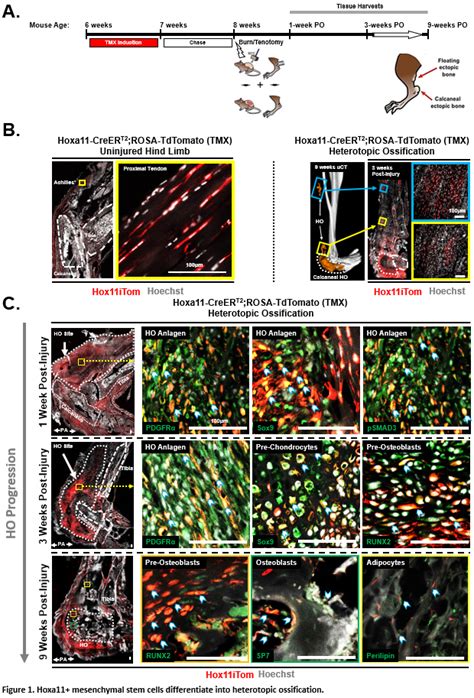 Psrc Novel Lineage Tracing System To Identify Site Specific Ectopic