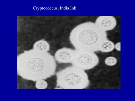 PPT Cryptococcus Neoformans And Other Yeast PowerPoint Presentation Free Download ID