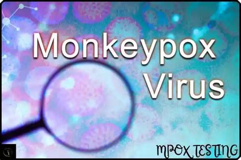 Learn 6 Pakistani Designated Monkeypox Testing Laboratories