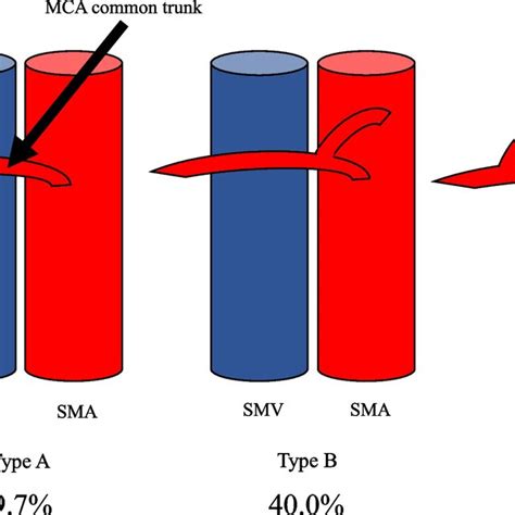 The Relationship Between The Smv And The Mca Type A A Common Trunk Download Scientific