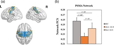 Reduced Primary Sensorimotor Area Psma Network Functional Download Scientific Diagram