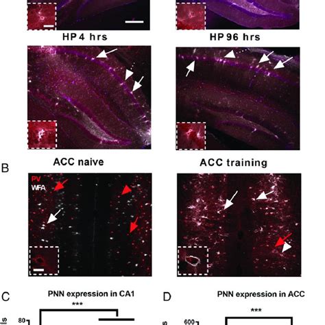 Optogenetic Manipulations Of Pv Interneurons Affected The Theta Download Scientific Diagram
