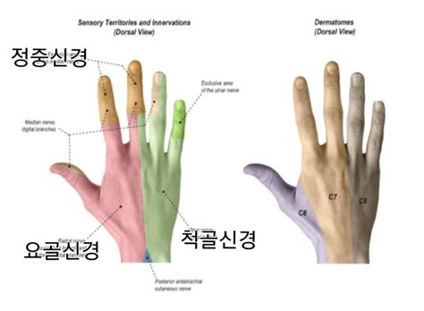 엄지손가락 통증과 저림증상 때문에 힘들어요 네이버 블로그