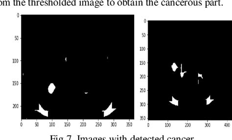 Figure 1 From Lung Cancer Detection Using Image Processing Techniques And Its Classification
