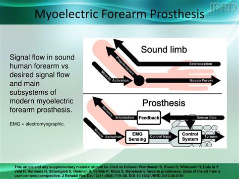 Ppt Myoelectric Forearm Prostheses State Of The Art From A User Centered Perspective