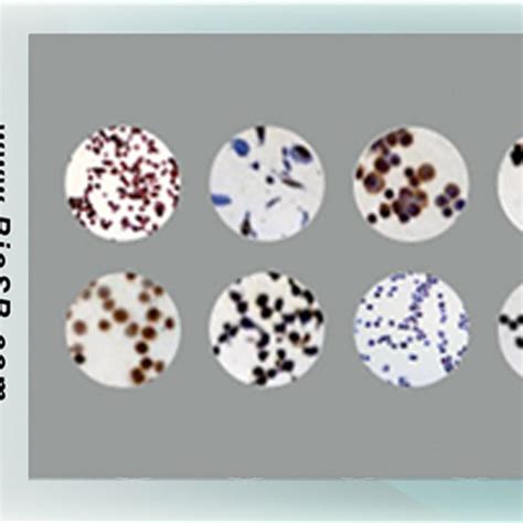 Core Normal Human Tissue Microarray Bio SB