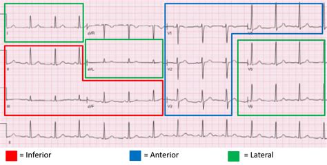 Management Of The Medical Patient In Remote And Rural Location