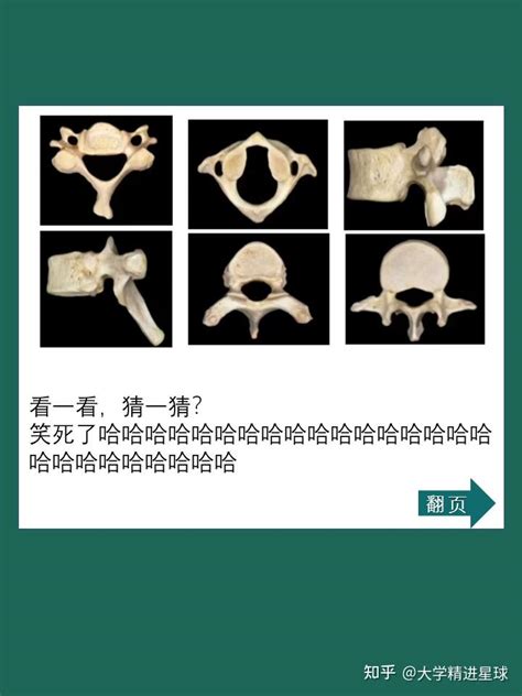 解剖学表情包 名词解释 知识点汇总 期末考试满分高分必备 课重点笔记 最全高频考点 知识点汇总 学习日常 电子版pdf资料 可打印 网课笔记