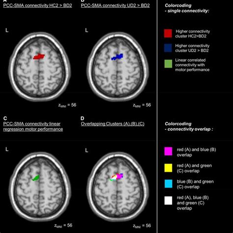 Pcc Connectivity Differences Resting State Functional Connectivity Download Scientific Diagram