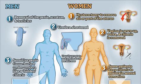 Non binary patient who underwent Barbie doll op to remove all sexµal organs reveals how