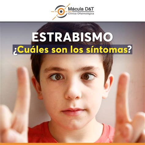 Macula Dandt El Estrabismo Es Un Problema Visual Que