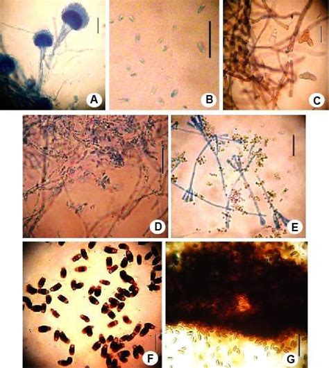 A Mycelium Conidiophore Vesicle And Conidia Of Aspergillus