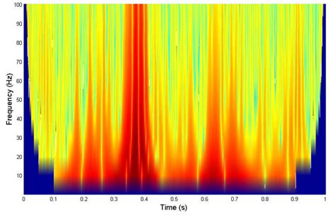 Cwt Of The Ecg Shown In Figure 1 In The Figure The Main Characteristic Download Scientific