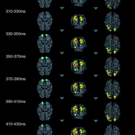 Group Cortical Current Density Maps To Target Words Showing The Download Scientific Diagram