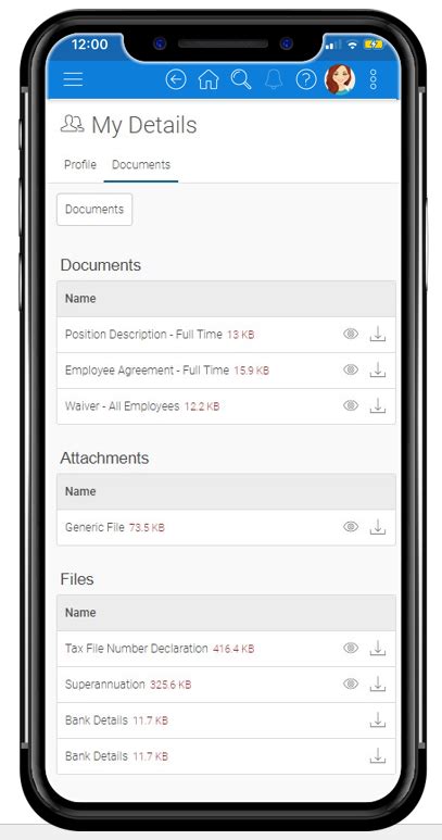 Contract Generation Blog Post Part 2 The Flexibility Of The