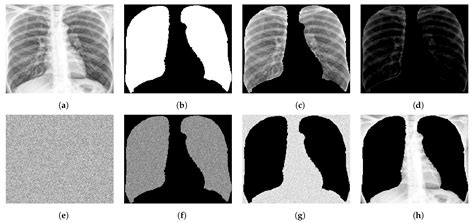 Diagnostics Free Full Text Generalization Challenges In Drug Resistant Tuberculosis