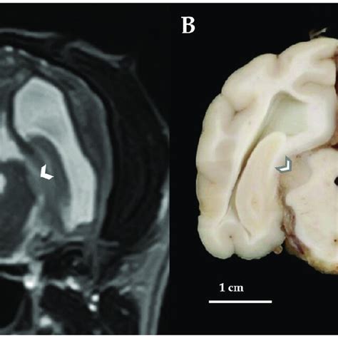 Post Mortem Mri Transverse T2w A And Frontal Brain Section Download Scientific Diagram