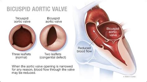 Atrioventricular Valve Function