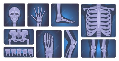 Premium Vector Xray Shots Human Skeleton And Body Parts Medical