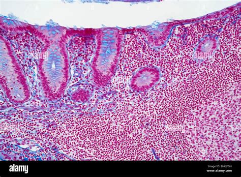 Appendix Lining Light Micrograph Stock Photo Alamy