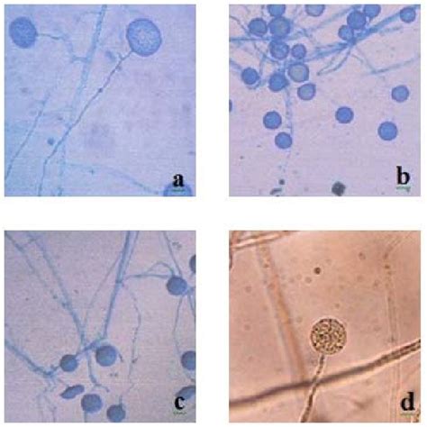 Morphological Sporangium Of Phytophthora 26 A Papillate Sporangium Download Scientific