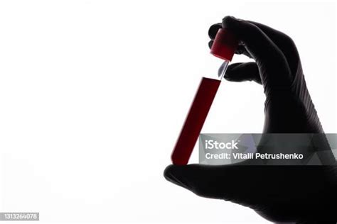 빨간 액체로 가득 찬 샘플을 채취하기위한 유리 용기 남자의 손에 닫고 흰색 배경에 고립 건강관리와 의술에 대한 스톡 사진 및 기타 이미지 건강관리와 의술 검사 보기