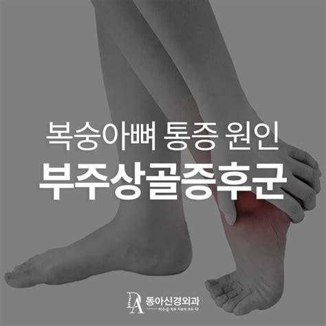 발목 복숭아뼈 통증 청소년기 흔한 부주상골 증후군 네이버 블로그