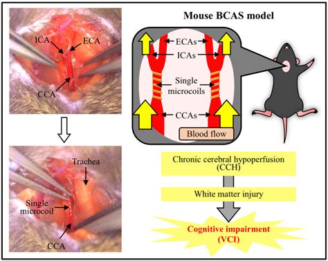 Bilateral Common Carotid Artery Stenosis In Mice A Model Of Chronic