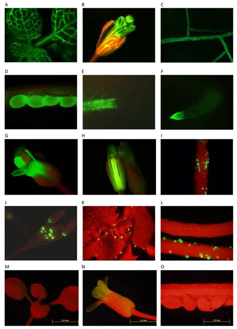 Examples Of The Expression Patterns From Different Promoter Reporter