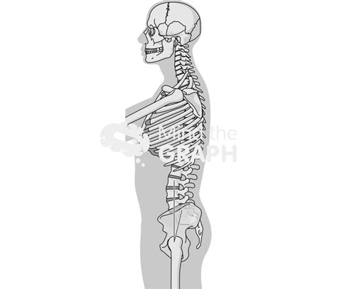 Spinopelvic Tilt Normal Body Mass Index Standing