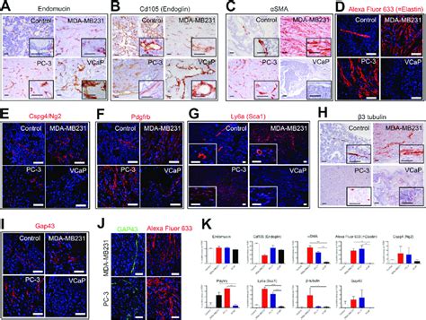 The Stroma Of Osteolytic Bone Metastasis Is Comprised Of An Arterial Download Scientific