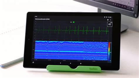 Challenging Long Term Ecg Signals Visualization On Android