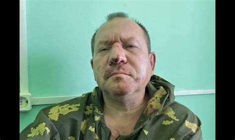 Глава Команды против пыток показал фото избитого члена СПЧ Игоря Каляпина