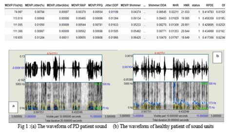 Speech Based Parkinsons Disease Detection Using Machine Learning