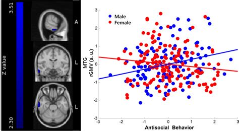 Figure 3 From Sex Dimorphic Cortical Brain Volumes Associated With