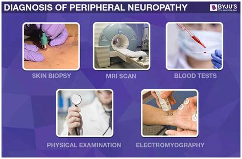 Peripheral Neuropathy Symptoms Causes Diagnosis And Treatments