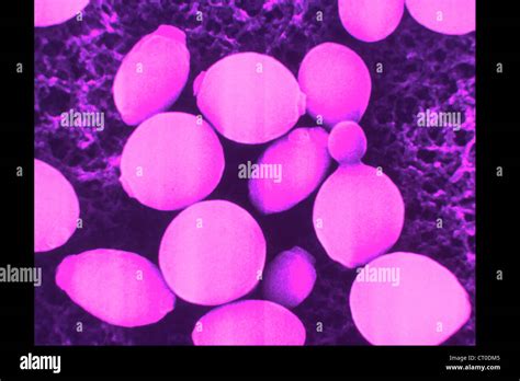 Cryptococcus Sem Hi Res Stock Photography And Images Alamy