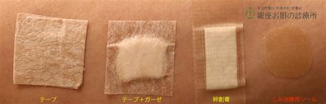 しみレーザー治療後のシール 銀座お肌の診療所【公式】