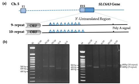 Allelic Variants On Slc6a3 Neurotransmitter Gene And Their Relationship