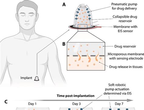 Robotic Self Modulation Enhances Implantable Long Acting Drug Delivery Devices Science Robotics