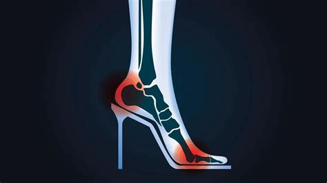 Los Zapatos Ideales Cuál Es La Altura Perfecta Que Debe Tener Un Taco