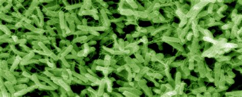 Scrna Seq Data Support Treating Inflammation Rather Than Bacteria In C Diff Infections Rna