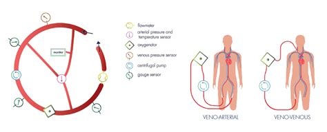 Extracorporeal Membrane Oxygenation ECMO HYB D O O