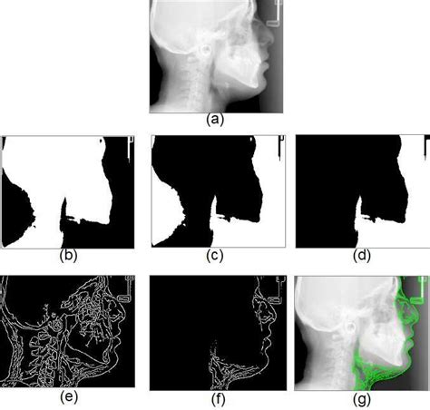 Proposed Schema To Detect Candidate Regions A The Input Image B Download Scientific